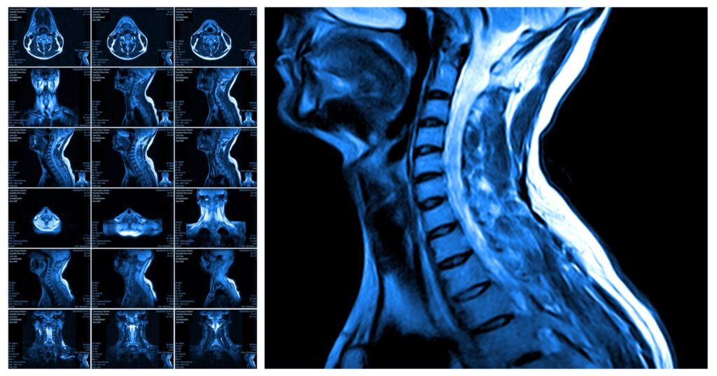 Section Spotlight: Neuroradiology - TRA Medical Imaging