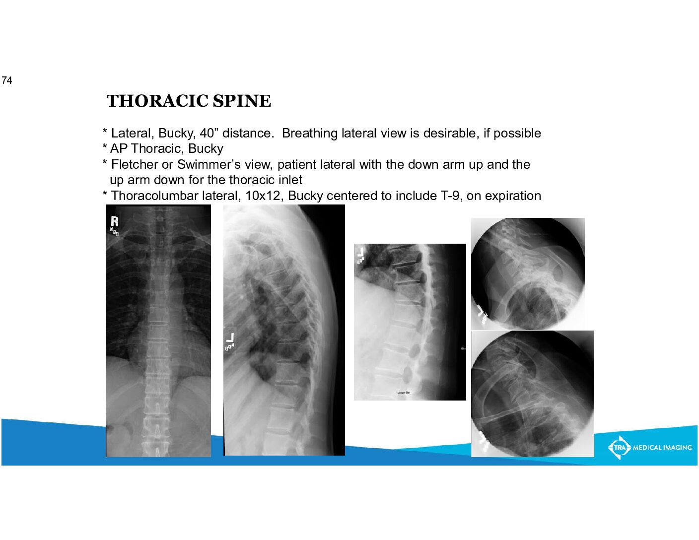 Thoracic Spine X Ray Views